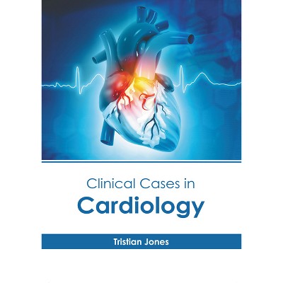 Nuclear Cardiology And Correlative Imaging - By Joao V Vitola ...